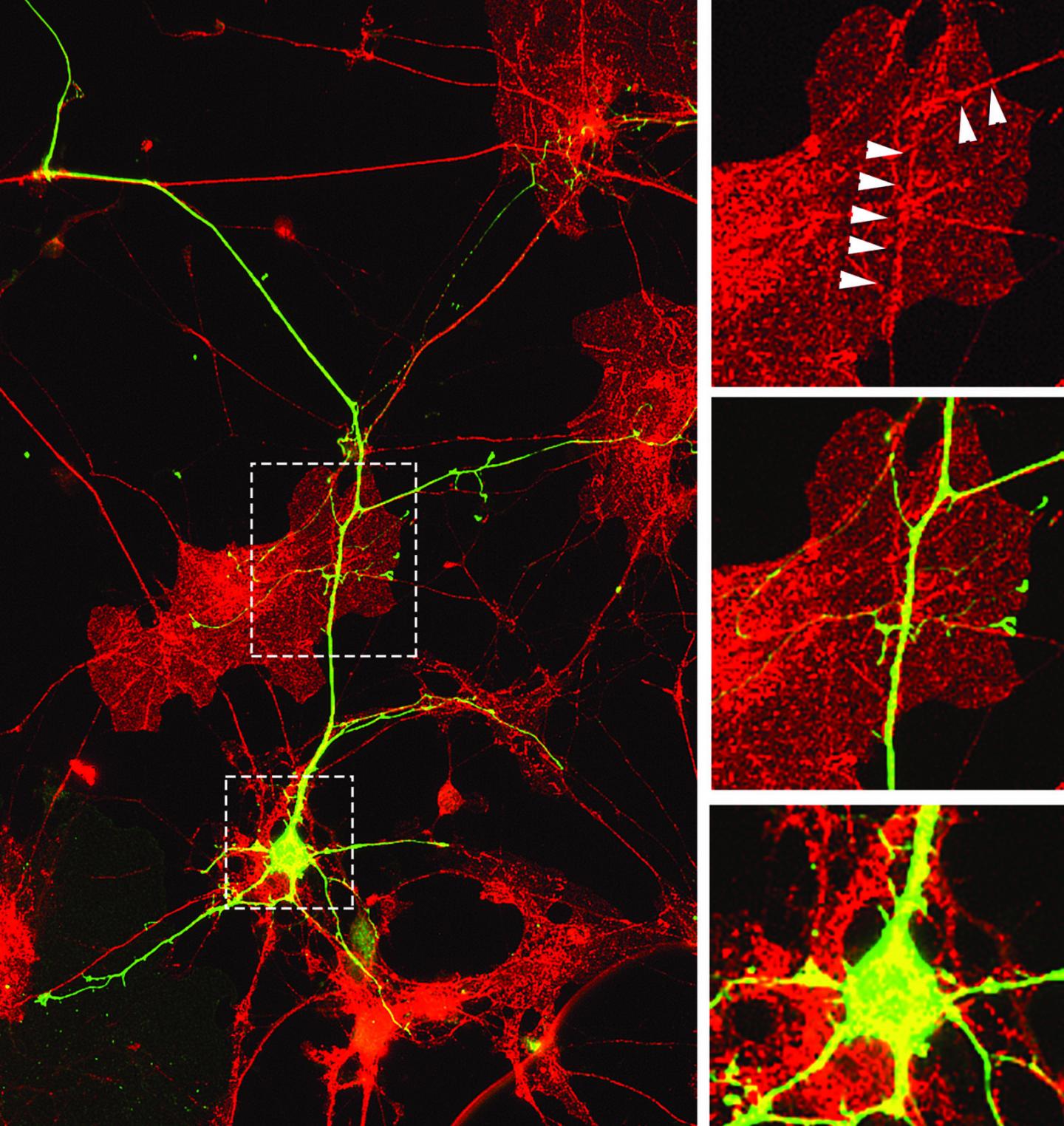 A cellular tree with healthy branches | EurekAlert!