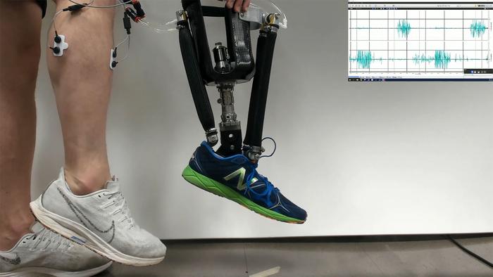 Robotic prosthetic ankles improve ‘natural’ m | EurekAlert!