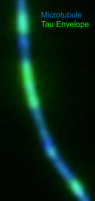 Understanding healthy function of tau, protei | EurekAlert!