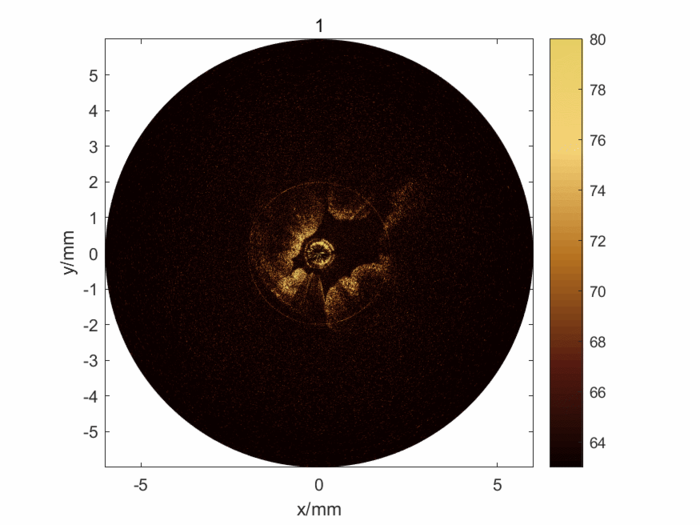 Dual-mode endoscope offers unprecedented insi | EurekAlert!