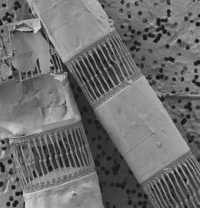 Skeletonema [IMAGE] | EurekAlert! Science News Releases