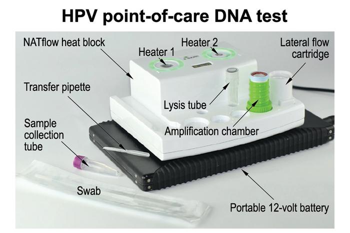 HPV point-of-care DNA test [IMAGE] | EurekAlert! Science News Releases