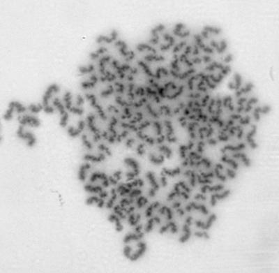 Aneuploidy -- Causes and Consequences (9 of 9 | EurekAlert!