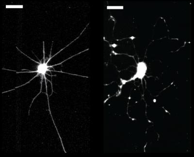 Healthy and Damanged Neurons [IMAGE] | EurekAlert! Science News Releases