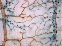 Controlling Inflated Blood Vessels (2 of 7) | EurekAlert!