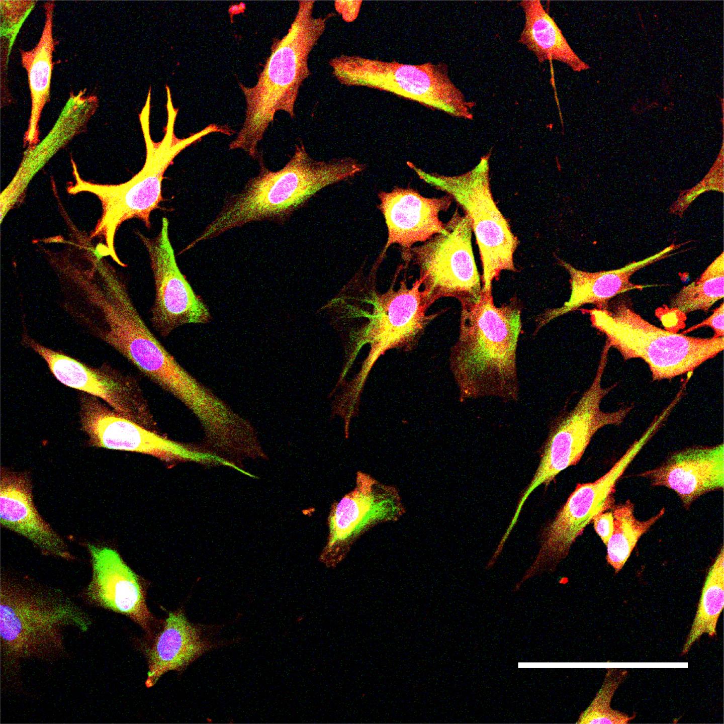 Astrocytes [IMAGE] | EurekAlert! Science News Releases