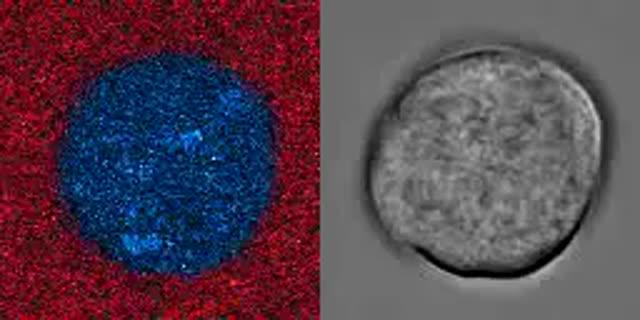 How Waves of Calcium Permit Platelets to Bind | EurekAlert!