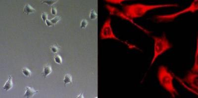 Transformation of Mouse Muscle [IMAGE] | EurekAlert! Science News Releases