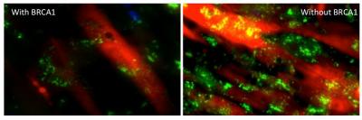 BRCA1 Plays a Critical Role in [IMAGE] | EurekAlert! Science News Releases
