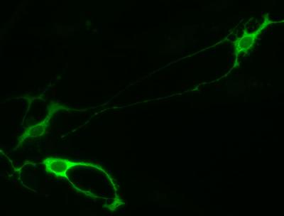 Reprogramming Brain Cells [IMAGE] | EurekAlert! Science News Releases