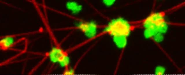 Video of blood clot contraction reveals how p | EurekAlert!
