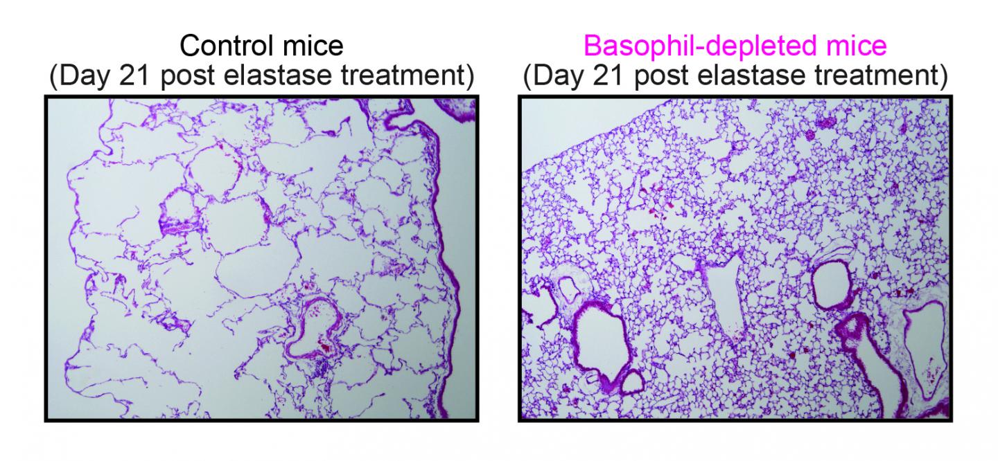 Researchers breathe new life into COPD resear | EurekAlert!