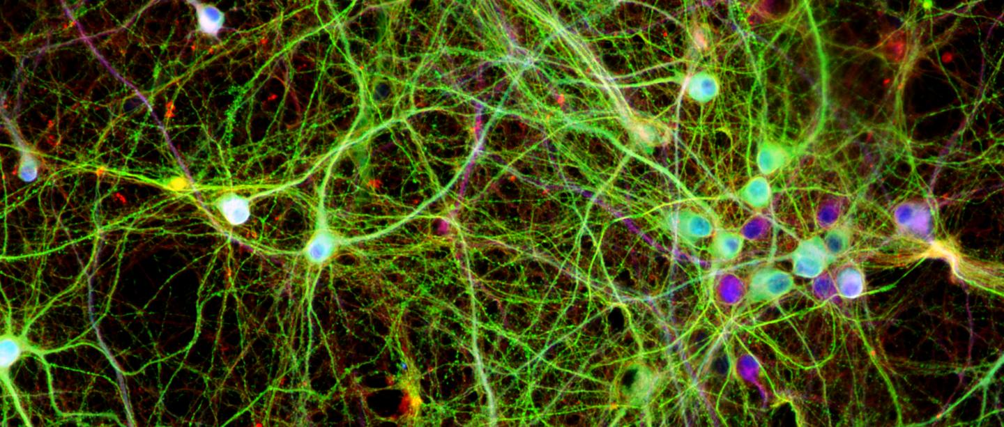 Cultured Neurons [IMAGE] | EurekAlert! Science News Releases