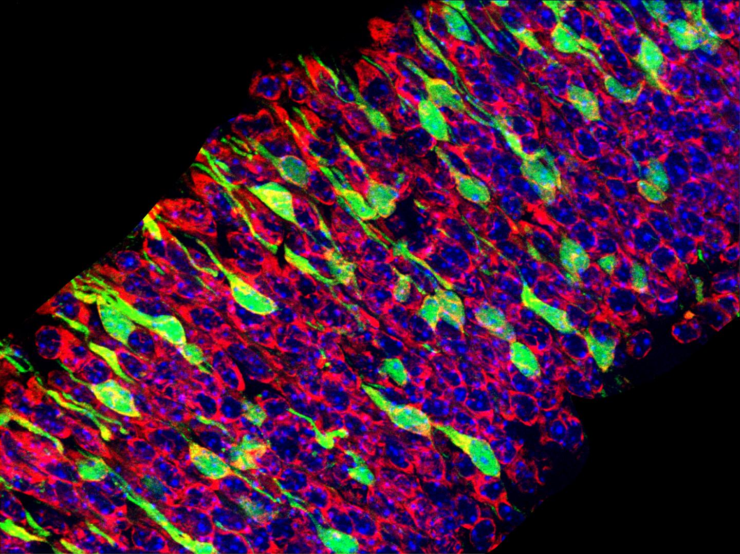 Mouse Neurons [IMAGE] | EurekAlert! Science News Releases