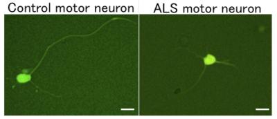 A drug-screening platform for ALS | EurekAlert!
