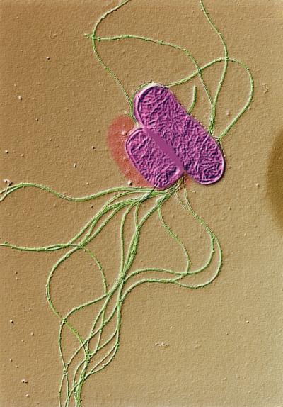 Salmonella Typhimurium [IMAGE] | EurekAlert! Science News Releases