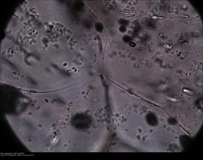 Cloudy, With a Chance of Microbes (2 of 2) | EurekAlert!