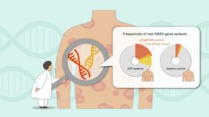 Missing disease-related gene identified in ge | EurekAlert!