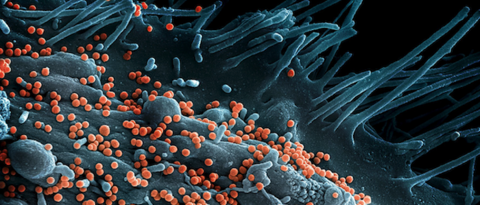 LJI scientists discover clue to stopping Lass | EurekAlert!