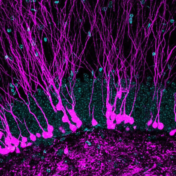 Neurons in the mouse hippocamp [IMAGE] | EurekAlert! Science News Releases