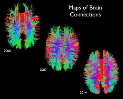 Maps of Brain Connections [IMAGE] | EurekAlert! Science News Releases