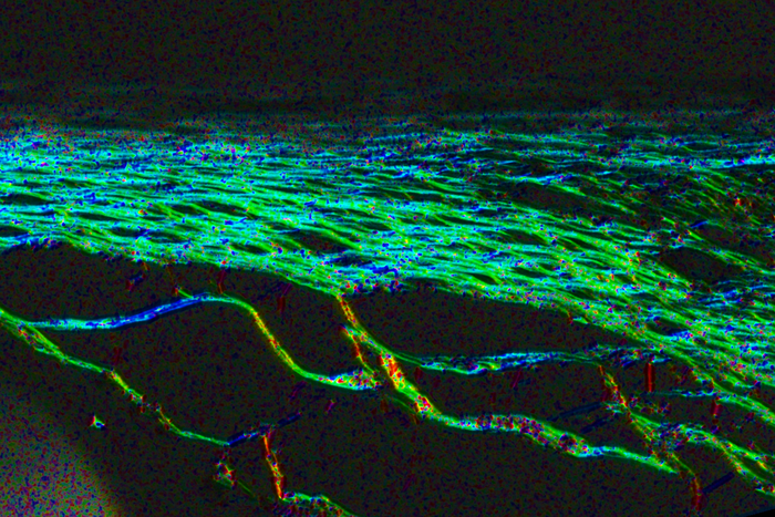 Scar TIssue [IMAGE] | EurekAlert! Science News Releases