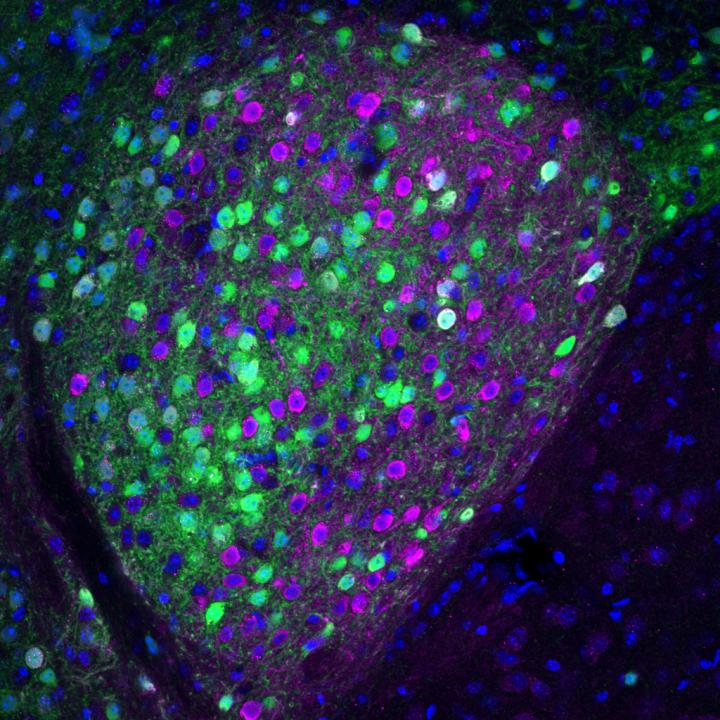 Neurons [IMAGE] | EurekAlert! Science News Releases