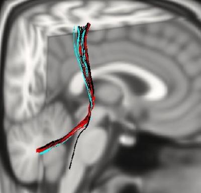 Cable Connections in the Brain [IMAGE] | EurekAlert! Science News Releases