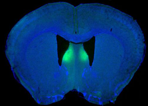 Lateral Septum in Male Mouse B [IMAGE] | EurekAlert! Science News Releases