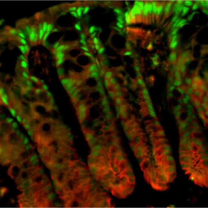 Colonic Crypt [IMAGE] | EurekAlert! Science News Releases