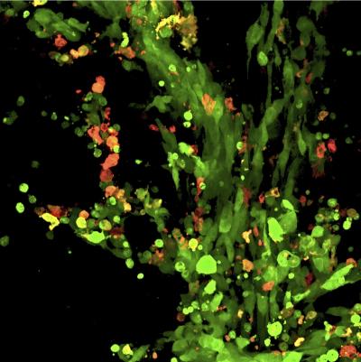 Galectin-Lacking Brain Tumor C [IMAGE] | EurekAlert! Science News Releases