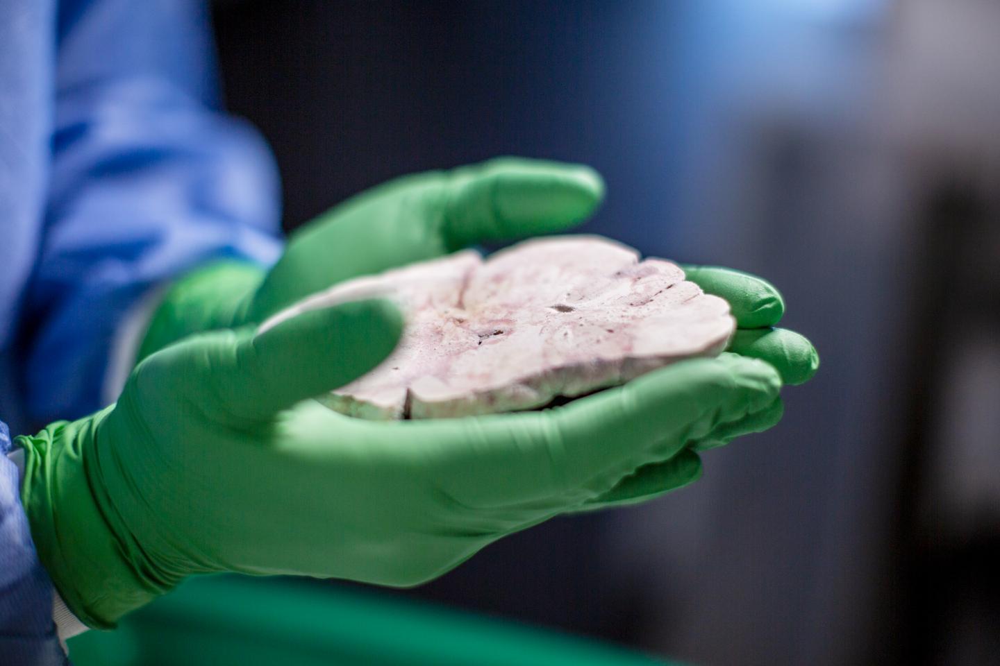 Human Brain Sample (2 of 2) [IMAGE] | EurekAlert! Science News Releases