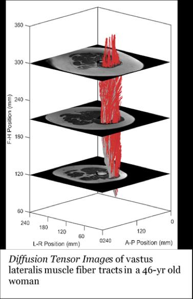 High-Tech Muscle Scan [IMAGE] | EurekAlert! Science News Releases