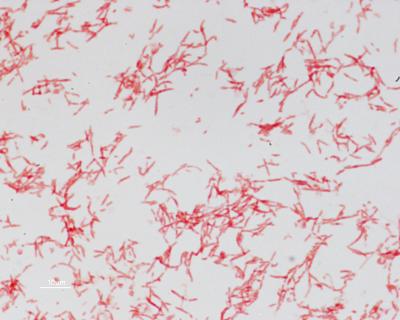 ETBF Gram Stain [IMAGE] | EurekAlert! Science News Releases