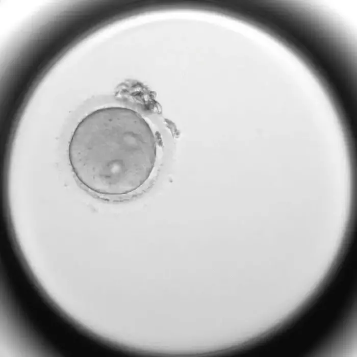 Researchers studied thousands of fertility at | EurekAlert!