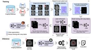 DeepWMH: a deep learning tool for accurate wh | EurekAlert!