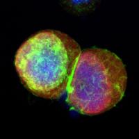 Viruses Lay Tracks in Host Cells | EurekAlert!