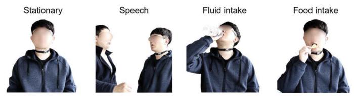 Neckband 2 [IMAGE] | EurekAlert! Science News Releases