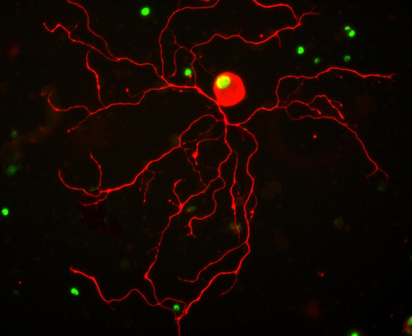 Rat Neonatal Dorsal Root Ganglion (DRG) Neurons Lonza, 54% OFF