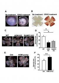 Protective effects of ADM-RAMP2 system make i | EurekAlert!