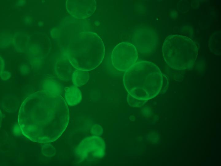 Healthy Organoids of the Mouse [IMAGE] | EurekAlert! Science News Releases