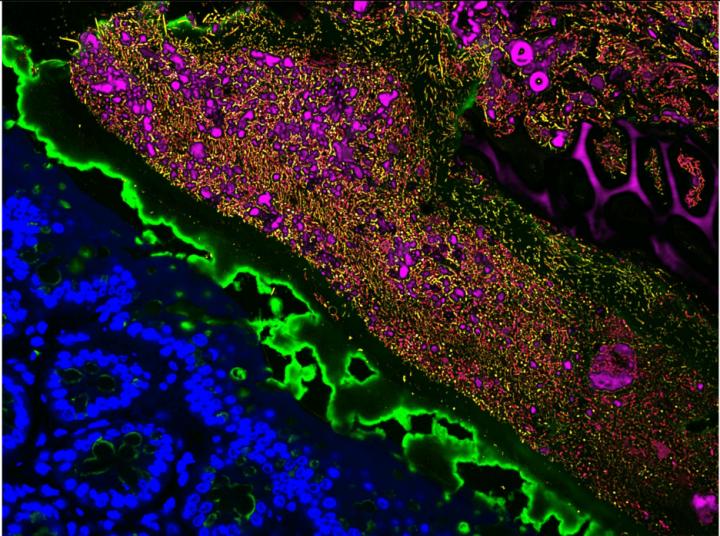 Microbiome species diversity [IMAGE] | EurekAlert! Science News Releases