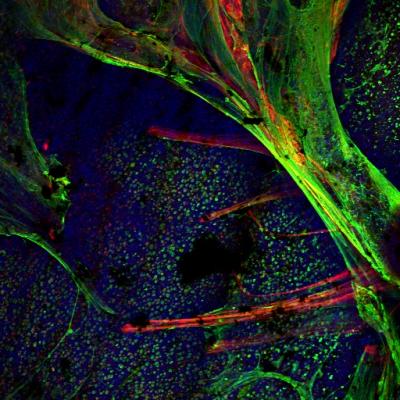 Cystic Fibrosis Mucus [IMAGE] | EurekAlert! Science News Releases