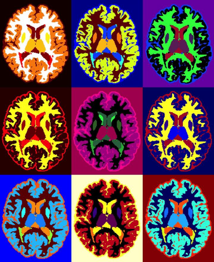 NWB:N [IMAGE] | EurekAlert! Science News Releases