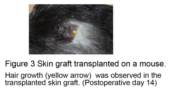 Figure 3 Skin graft transplant [IMAGE] | EurekAlert! Science News Releases