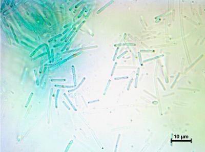 Cyanobacteria 2 [IMAGE] | EurekAlert! Science News Releases