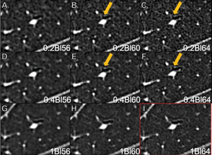 Ultra-high-resolution photon-counting detecto | EurekAlert!