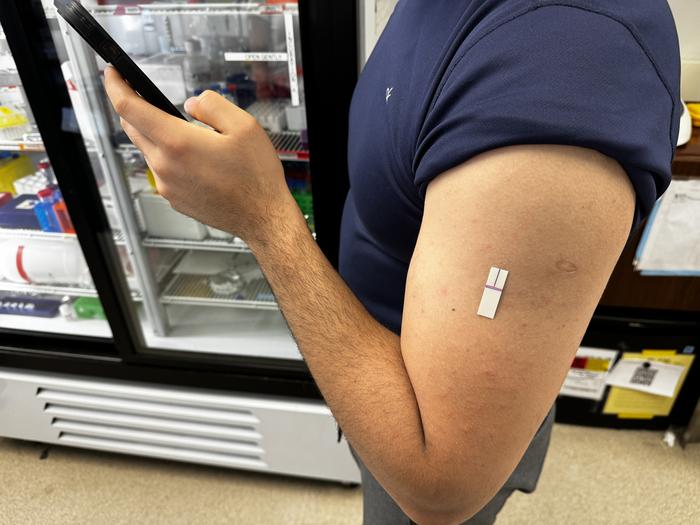 Patch on arm [IMAGE] | EurekAlert! Science News Releases