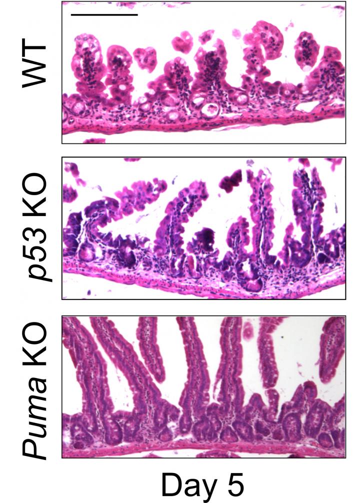 Protecting the Intestines from [IMAGE] | EurekAlert! Science News Releases