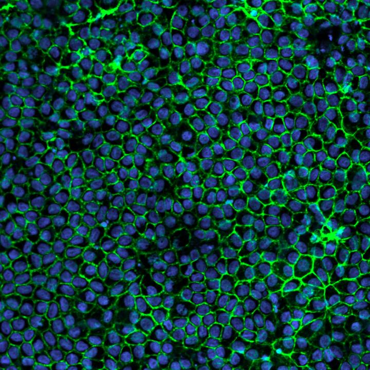 RPE cells derived from iPSCs [IMAGE] | EurekAlert! Science News Releases
